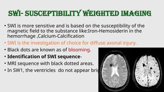 mri in ent final nejshdifndhsjjsbdhxhcopy.pptx