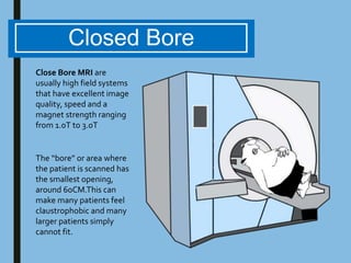 Open Bore Mri Denver
