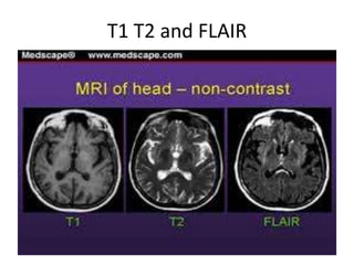 Neonatal MRI Brain | PPTX
