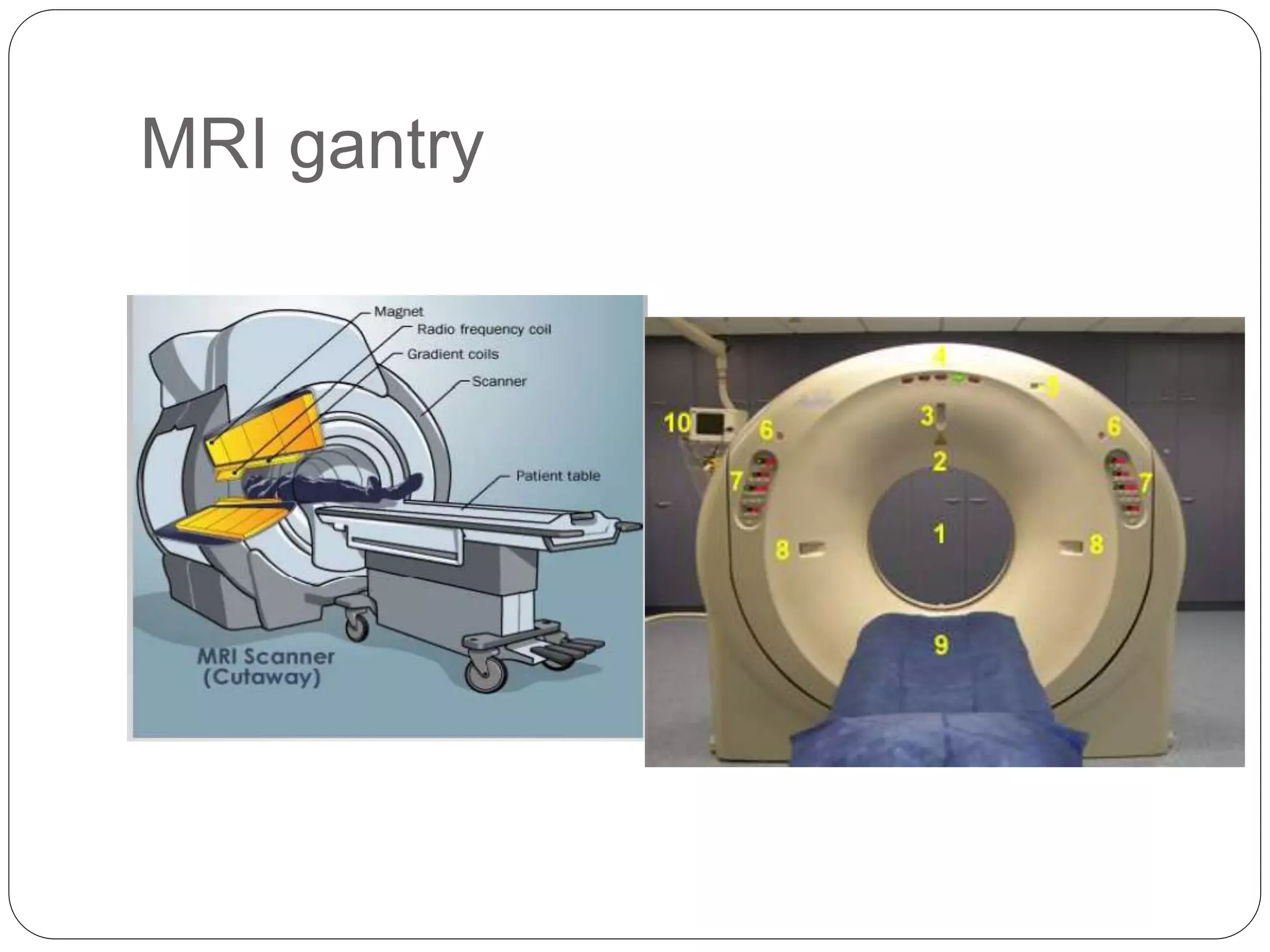 MRI in orthopaedics | PPTX