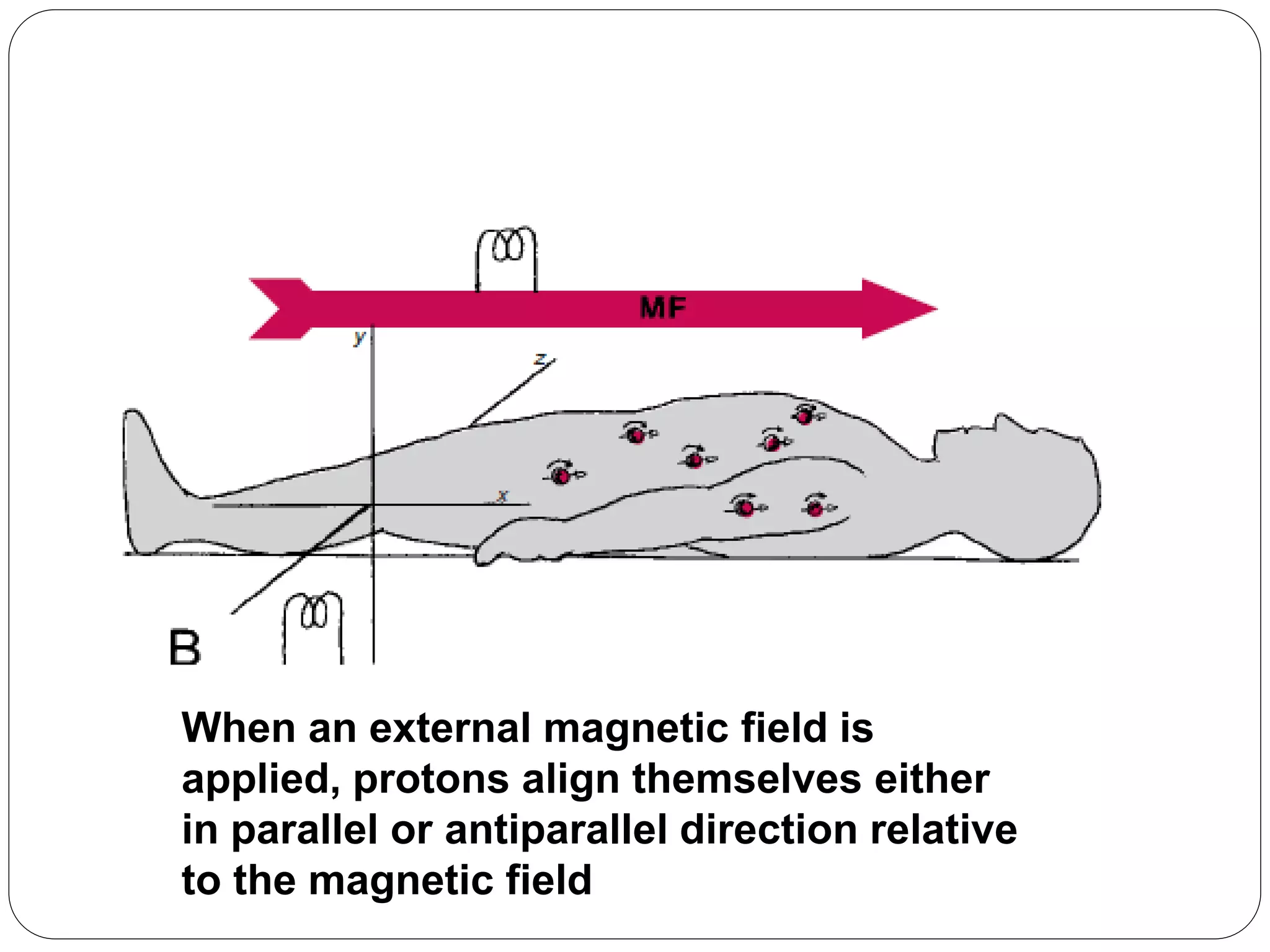 MRI in orthopaedics | PPTX