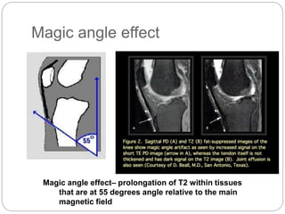 MRI in orthopaedics | PPTX