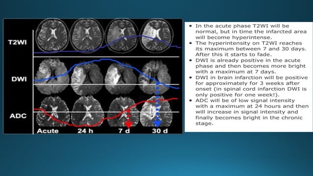 MRI IN STROKE RADIOLOGY PRESENTATION... | PPTX