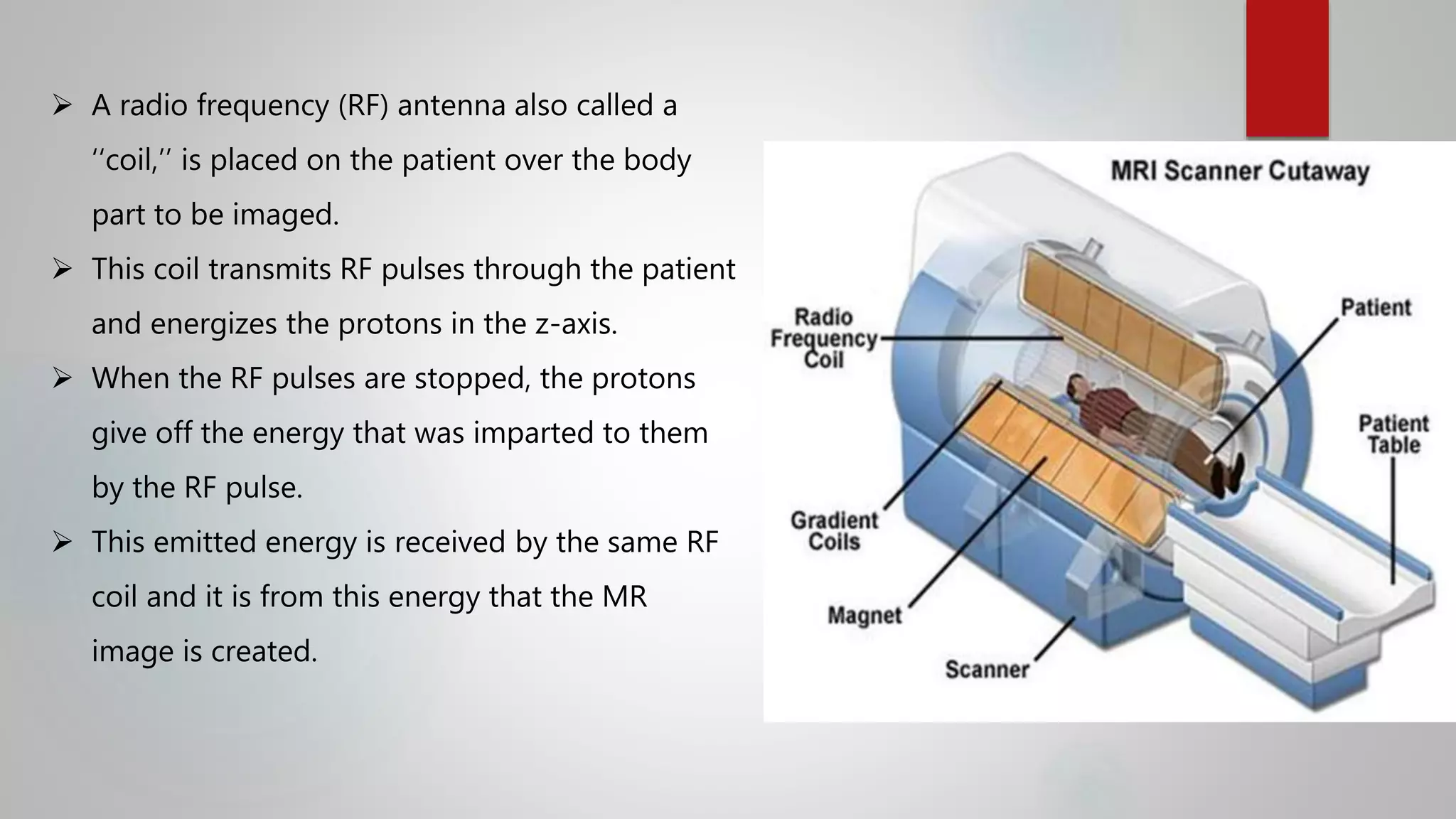 Mri in urology | PPTX