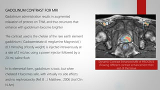 Mri in urology | PPTX