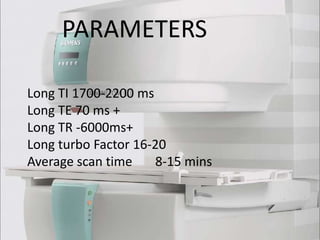 Mri inversion | PPTX