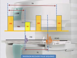 Mri inversion | PPTX