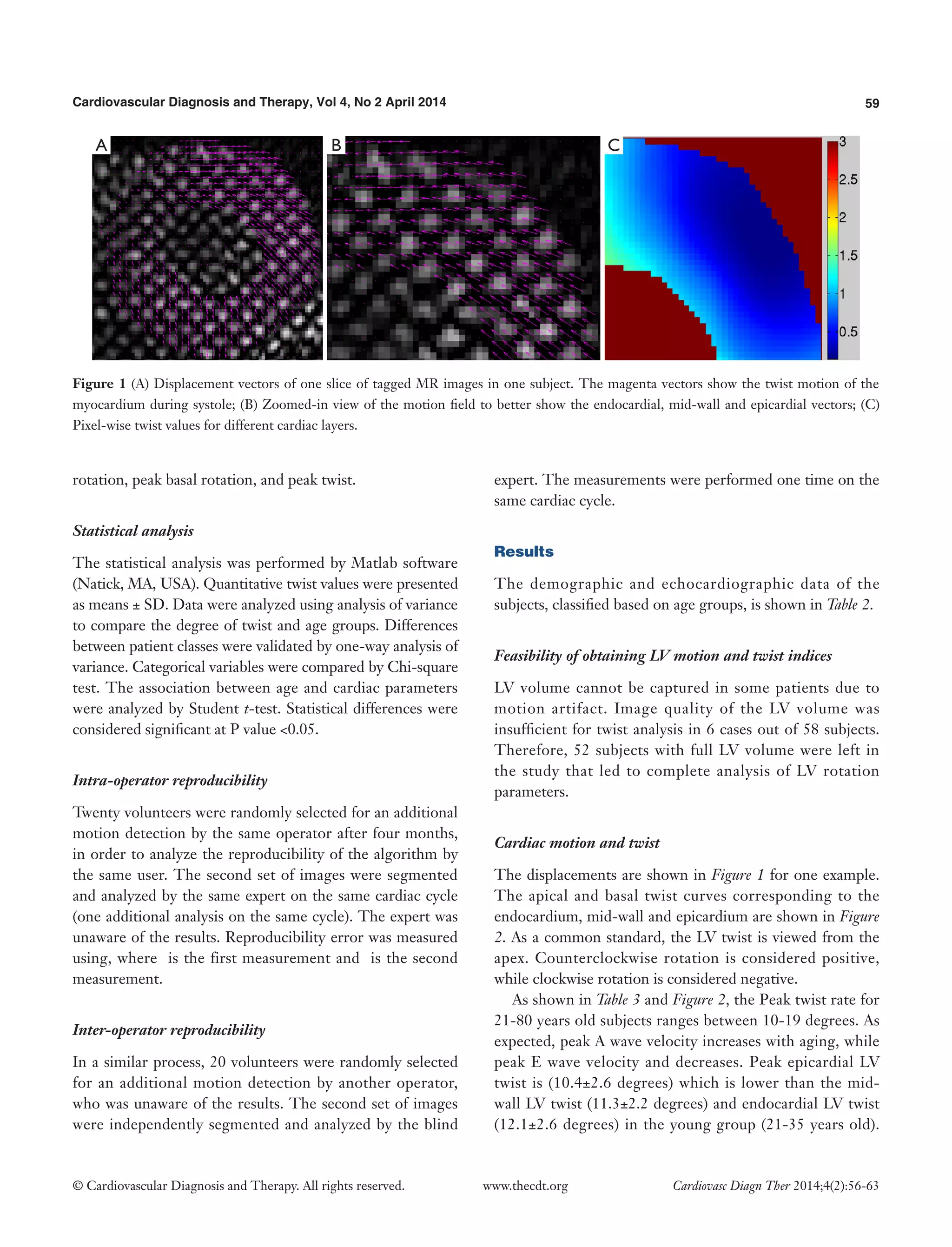 Assessment of subendocardial vs. subepicardial left ventricular twist ...