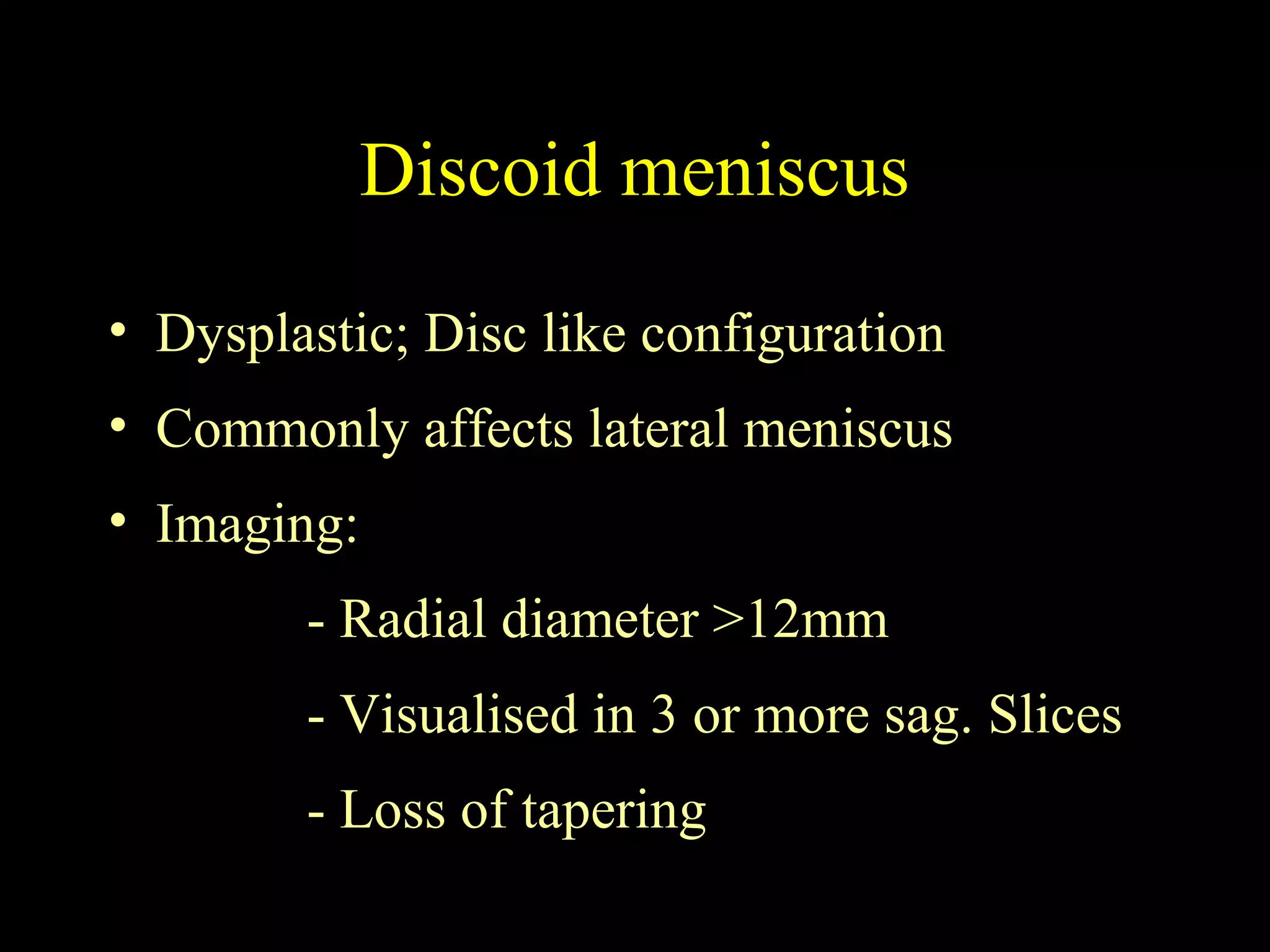 MRI Knee - Basics | PPT