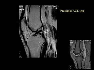 MRI Knee - Basics | PPT