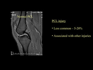 MRI Knee - Basics | PPT
