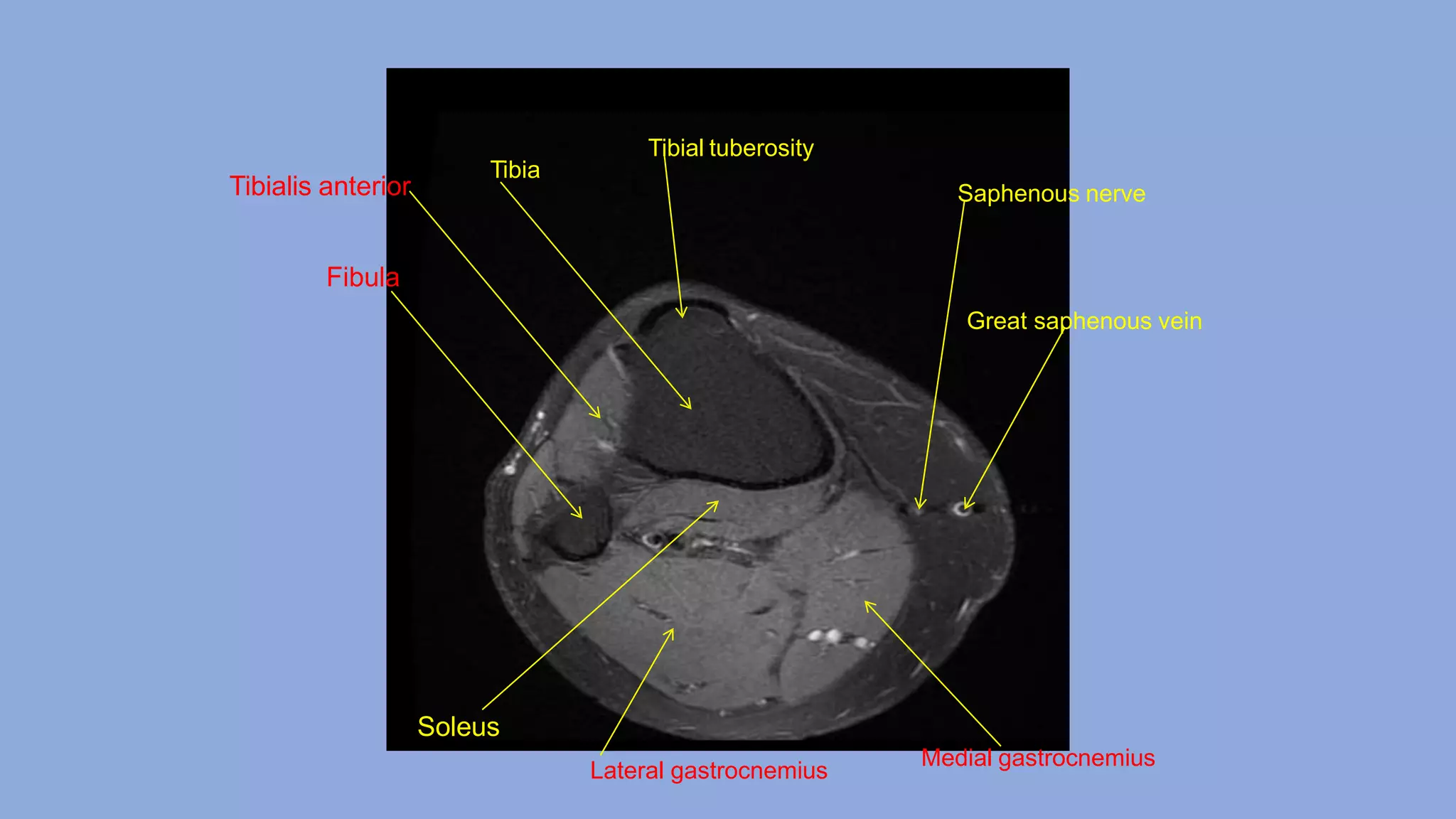 Mri knee and ankle anatomy presentation pk1 | PPTX