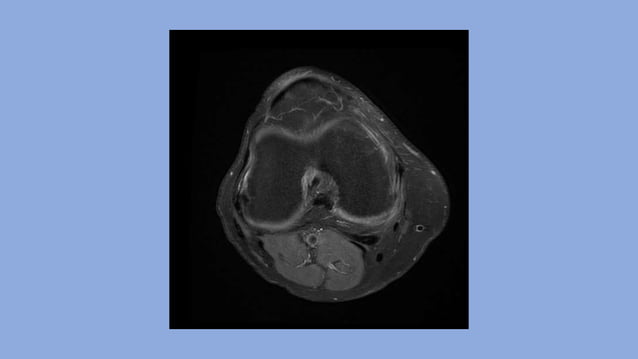 Mri knee and ankle anatomy presentation pk1 | PPTX | Death, Injury, or ...