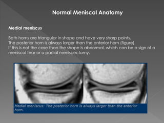 Mri knee trauma | PPTX