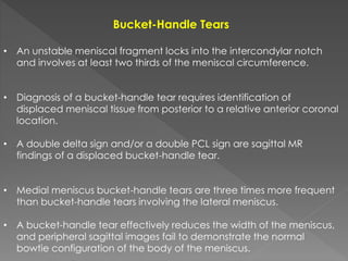Mri knee trauma | PPTX