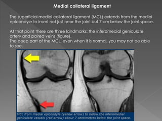 Medial Collateral Ligament Mri