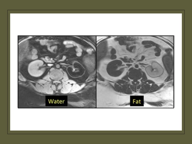magnetic resonnce imaging (MRI) slides.pptx