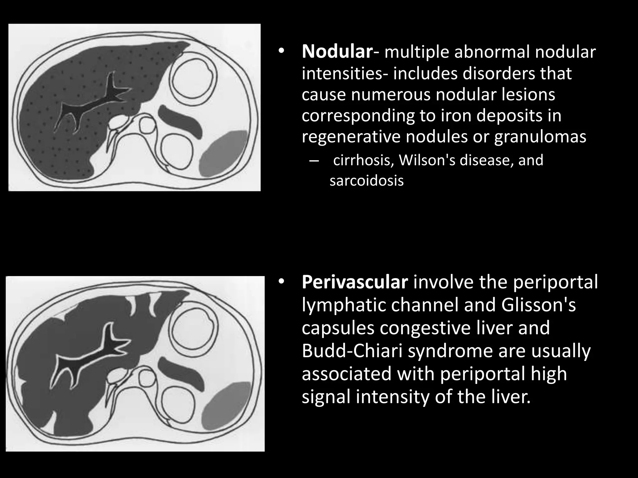 MR imaging of liver | PPTX