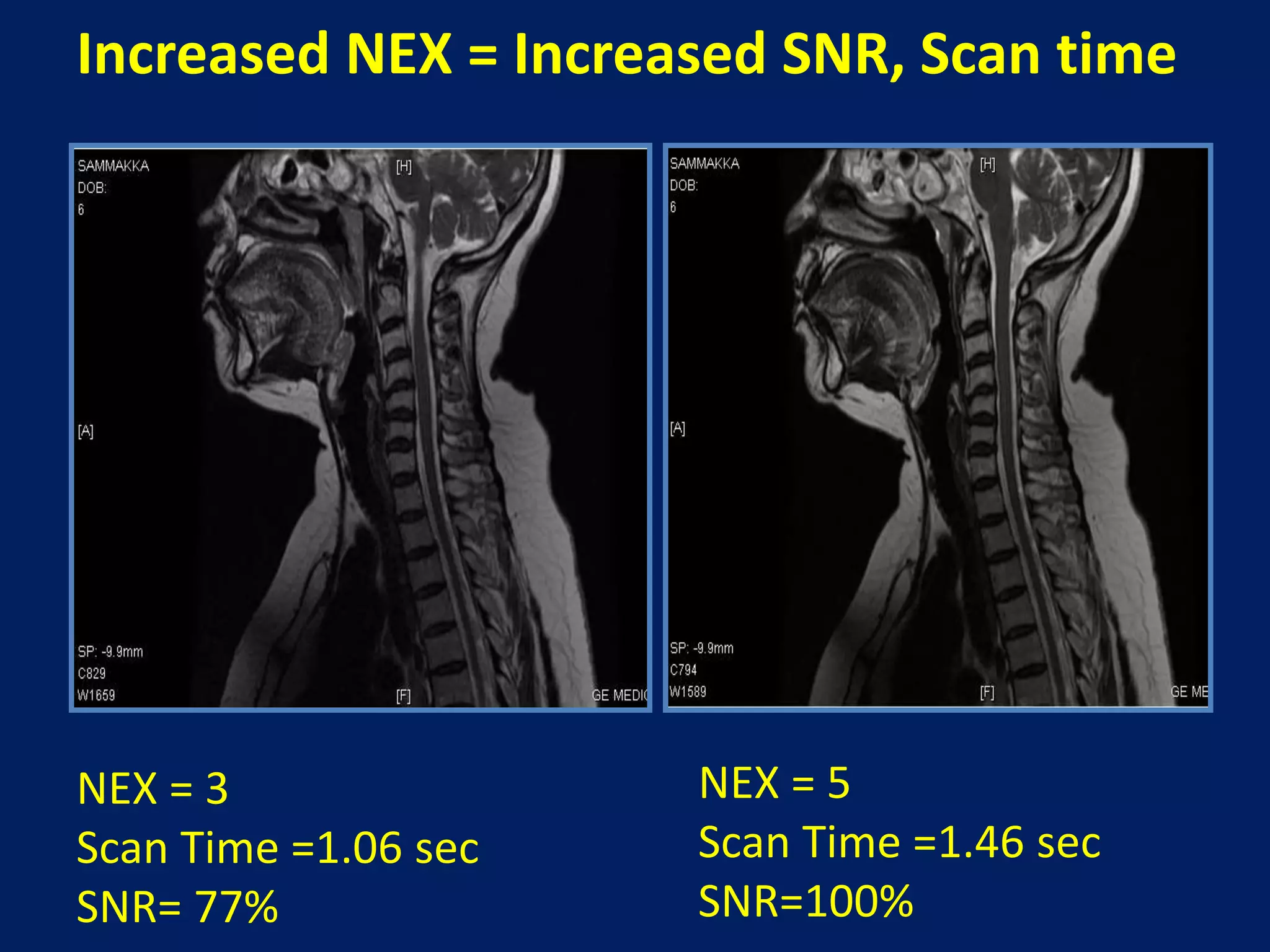 MR IMAGE QUALITY PARAMETERS.pptx