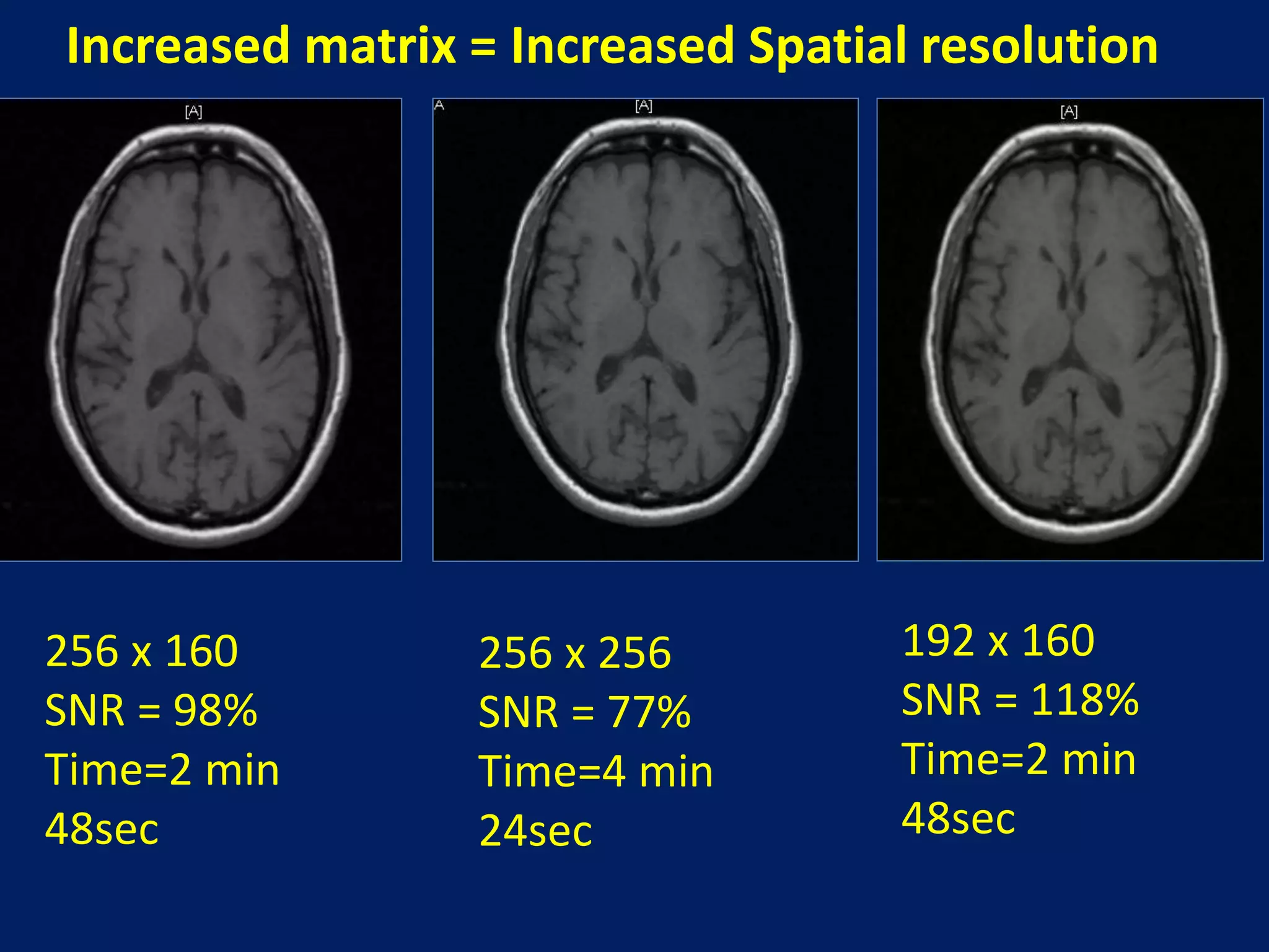 MR IMAGE QUALITY PARAMETERS.pptx