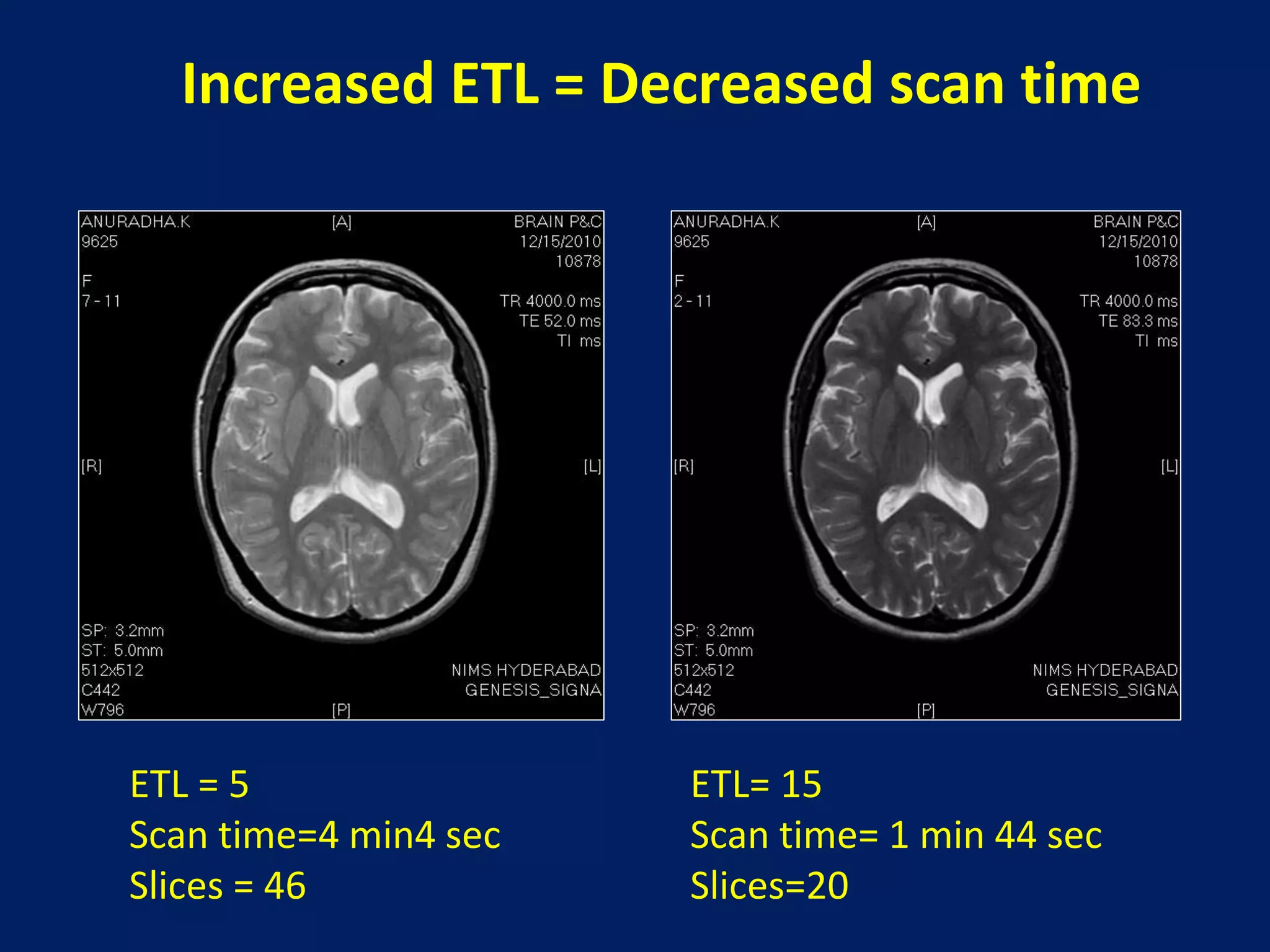 MR IMAGE QUALITY PARAMETERS.pptx