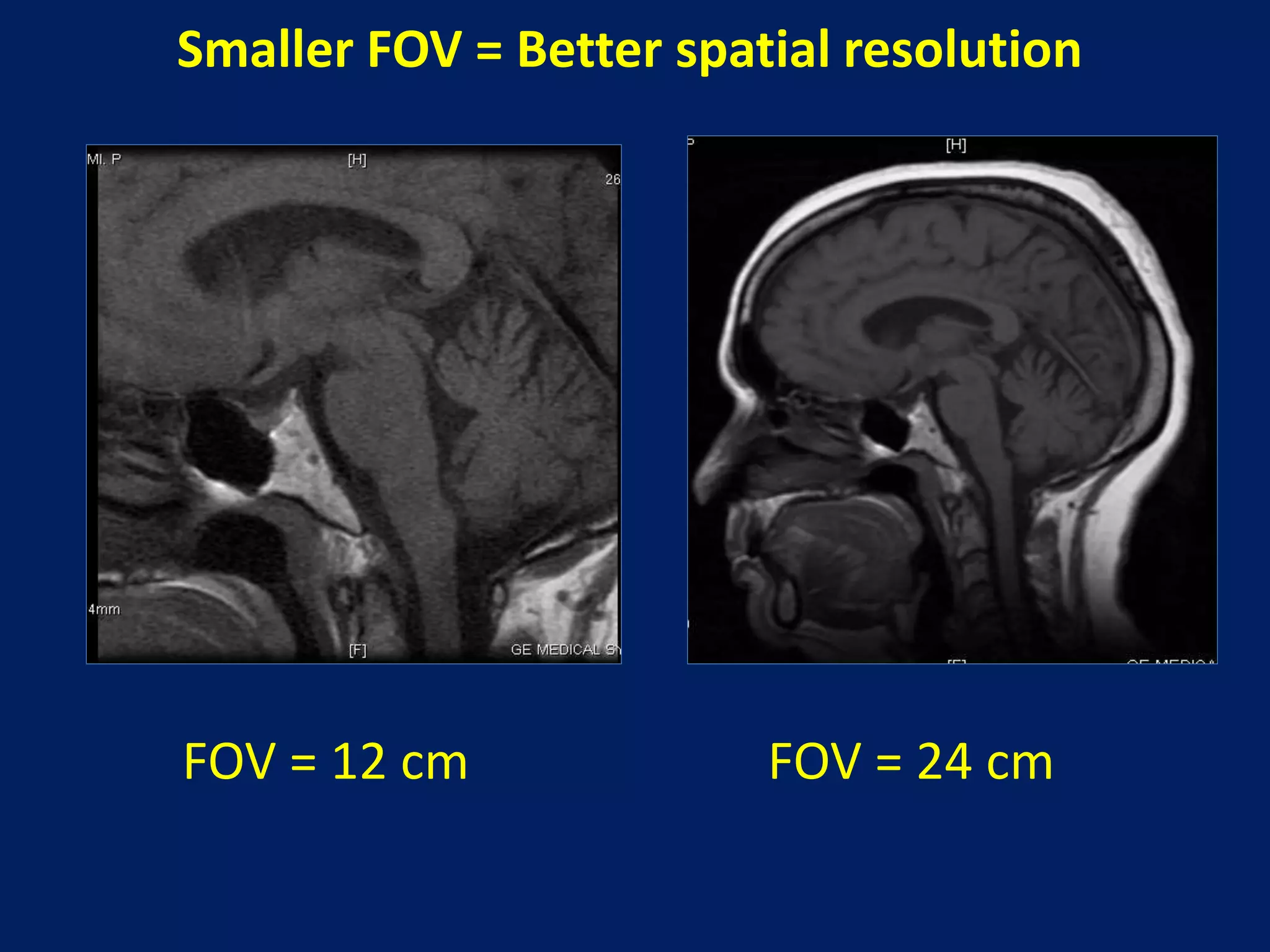 MR IMAGE QUALITY PARAMETERS.pptx