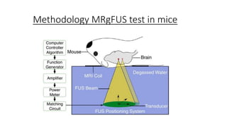 Mr imaging guided focused ultrasound - Dr. P. Seynaeve | PPT