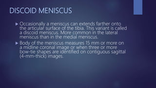 Mr imaging for diagnosis of meniscal tears | PPTX