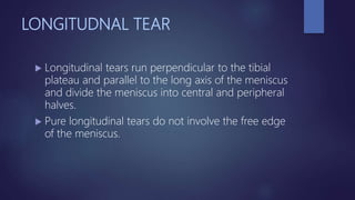 Mr imaging for diagnosis of meniscal tears | PPTX