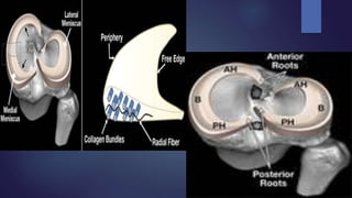 Mr imaging for diagnosis of meniscal tears | PPTX
