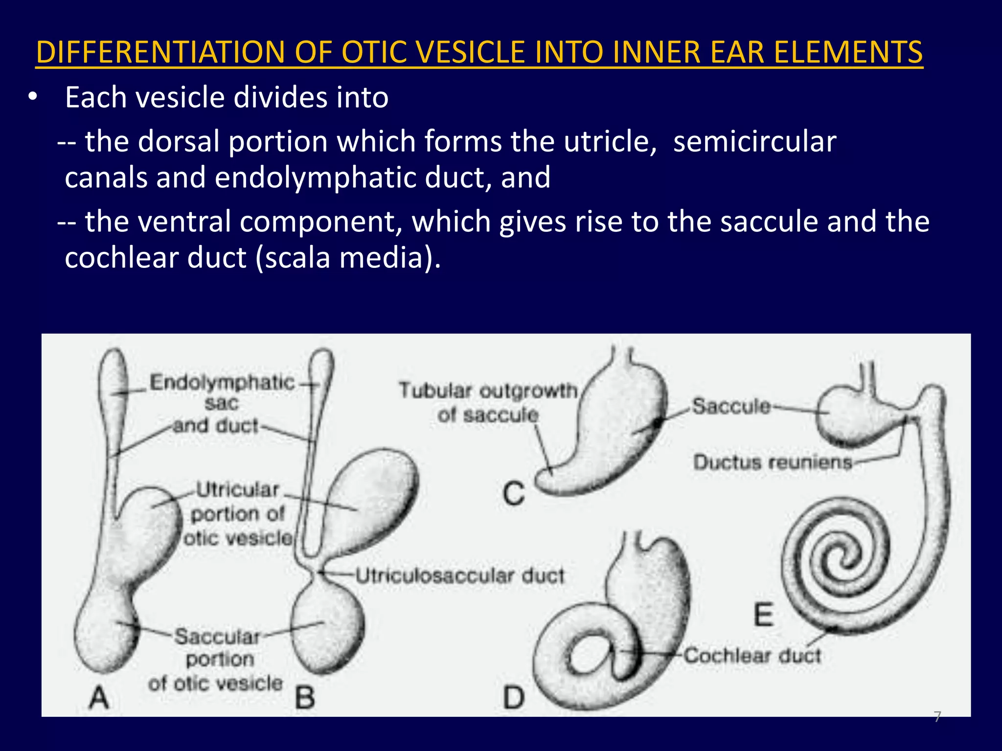 Magnetic Resonance Imaging Of Inner Ear | PPTX
