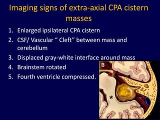 Magnetic Resonance Imaging Of Inner Ear | PPT