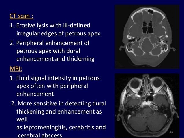 Magnetic Resonance Imaging Of Inner Ear