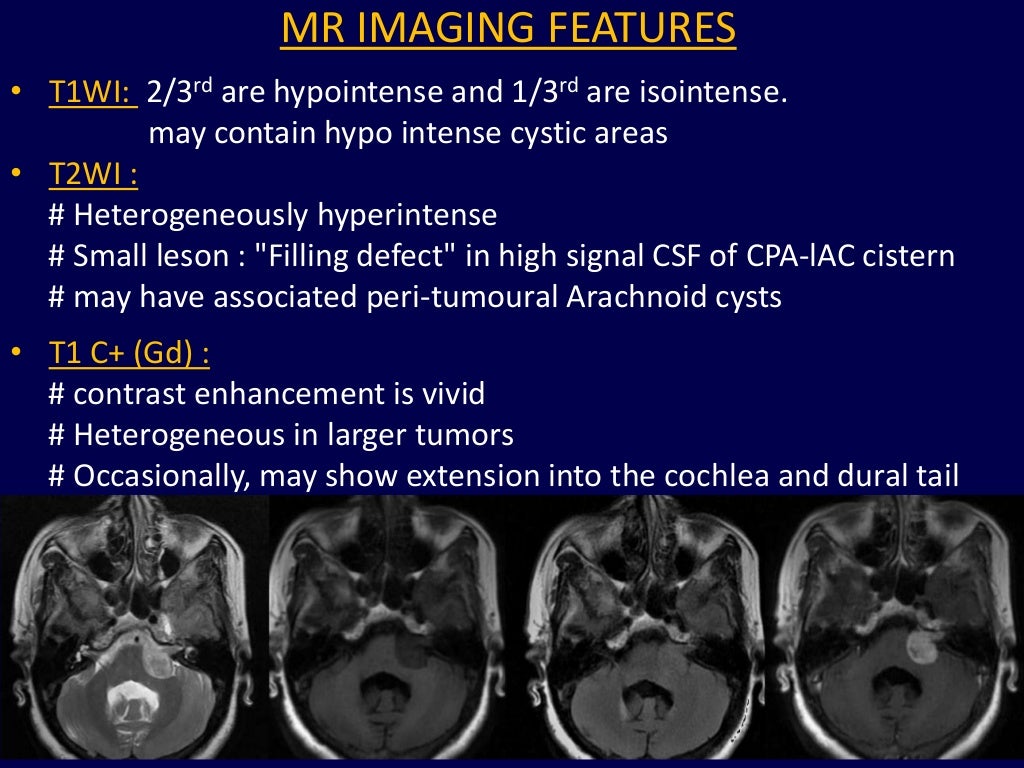Magnetic Resonance Imaging Of Inner Ear
