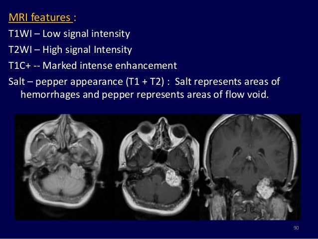 Magnetic Resonance Imaging Of Inner Ear