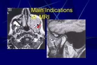 MRI magnetic resonance in head and neck | PPT