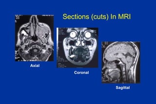 MRI magnetic resonance in head and neck | PPT