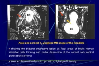MRI magnetic resonance in head and neck | PPT