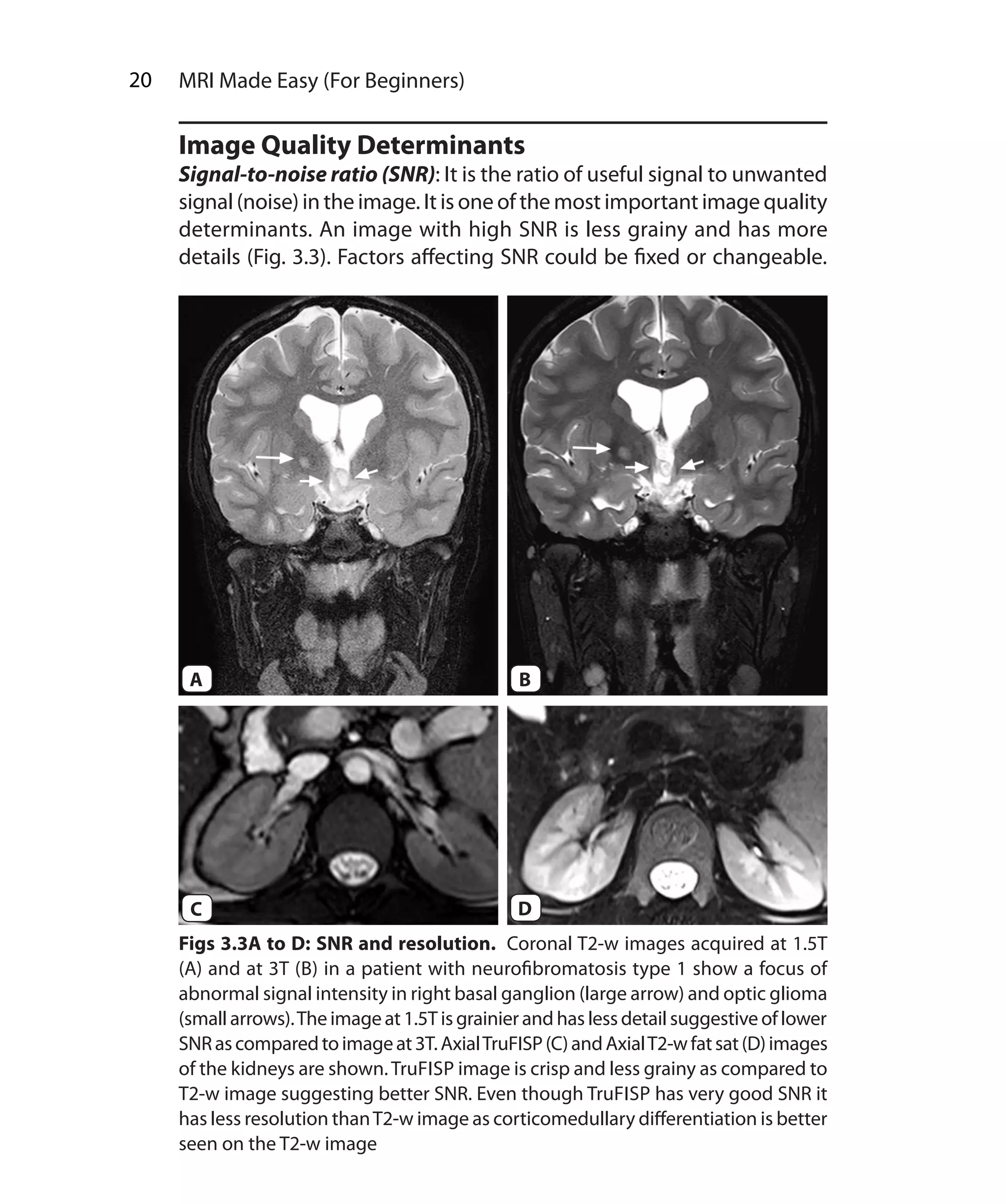 Mri make easy | PDF