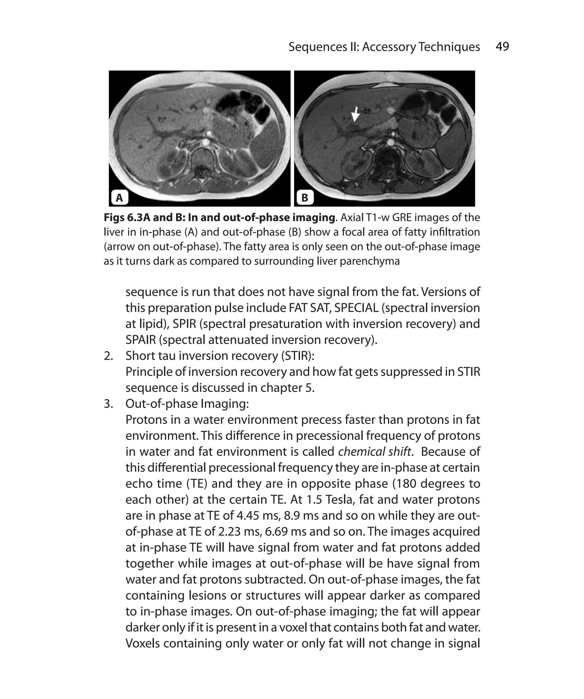 Mri make easy | PDF