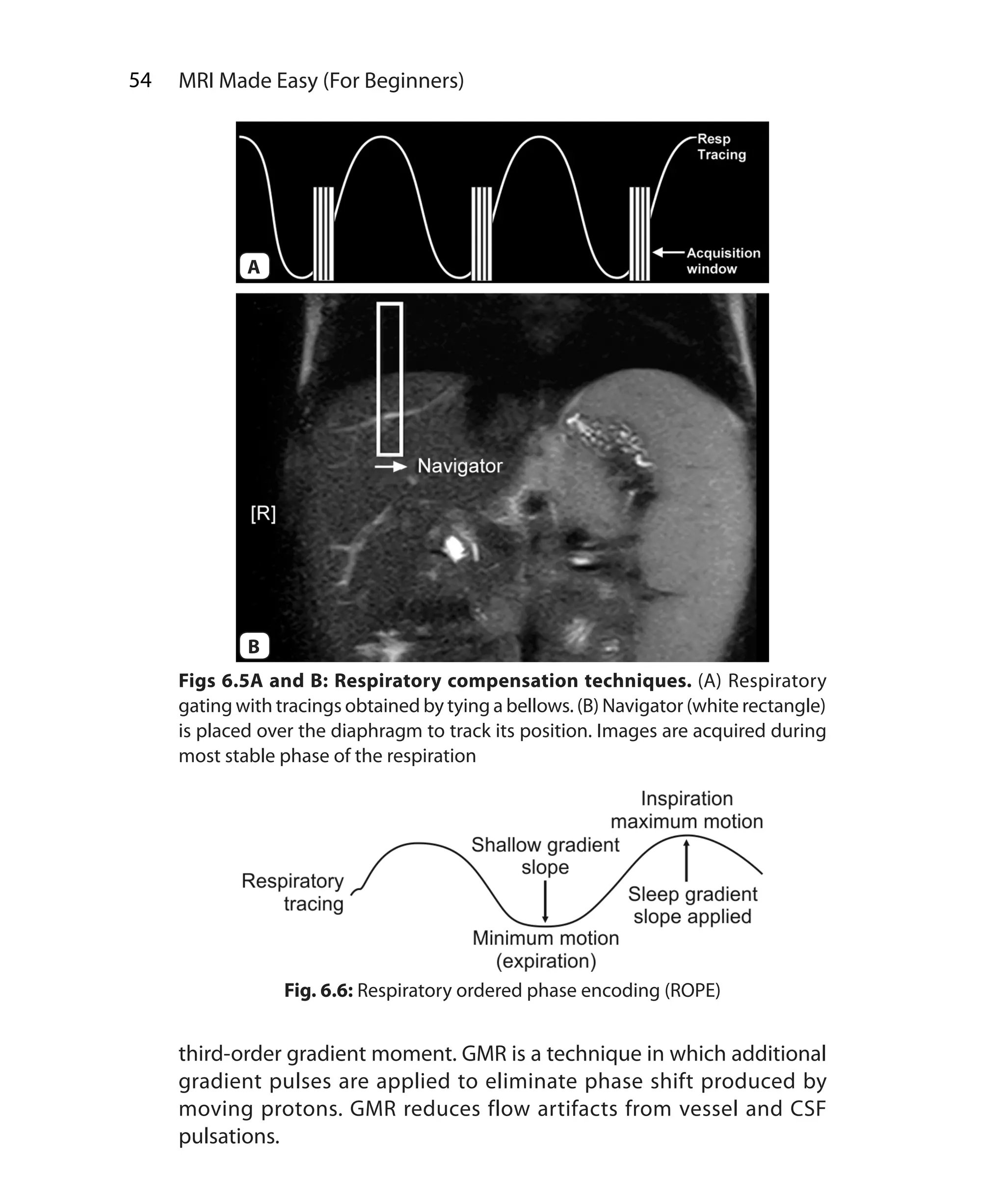 Mri make easy | PDF
