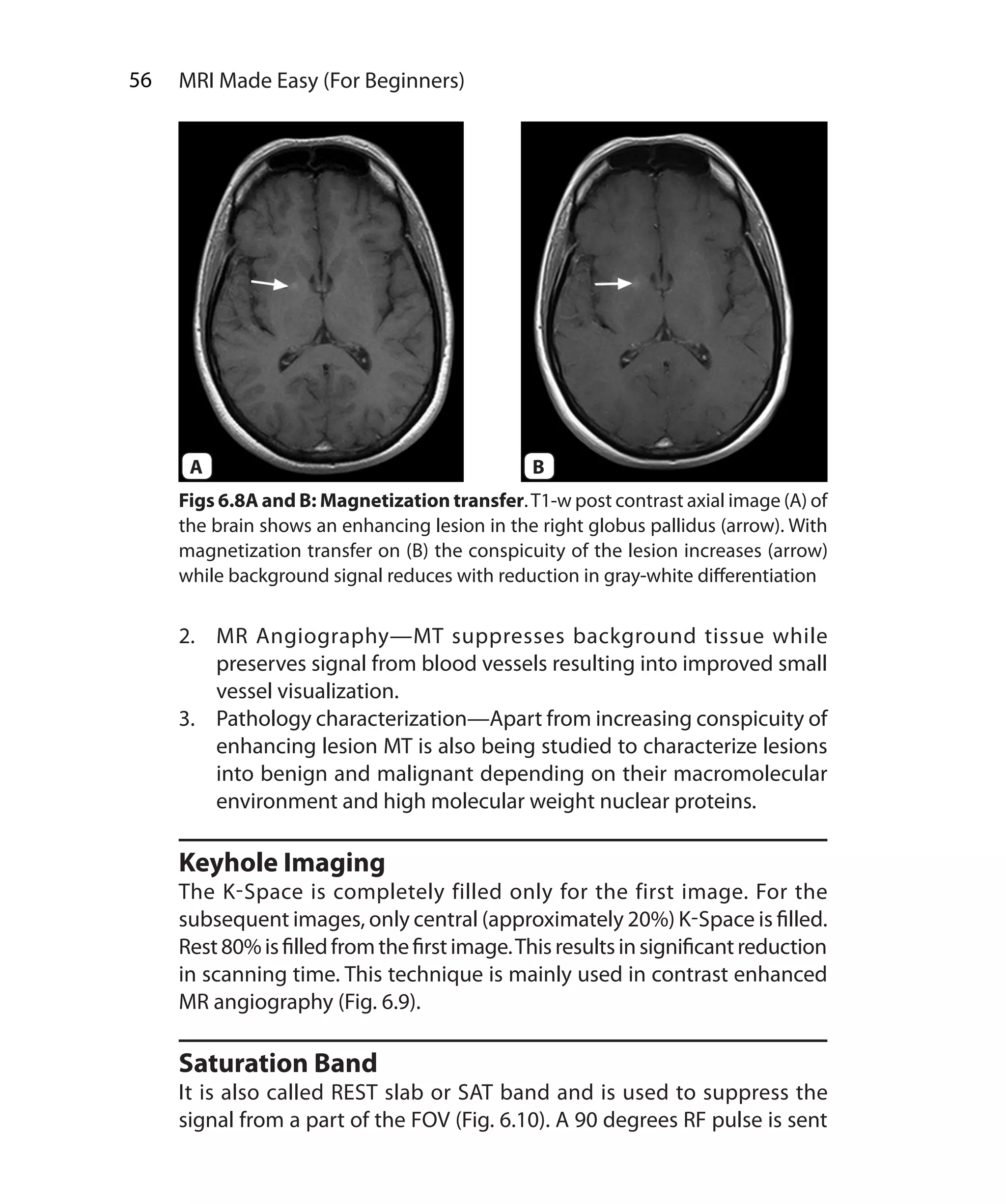 Mri make easy | PDF