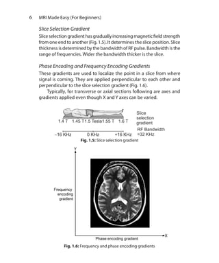 Mri make easy | PDF