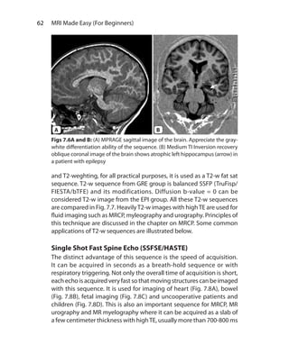 Mri make easy | PDF