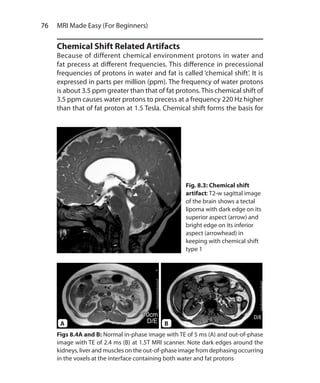 Mri make easy | PDF