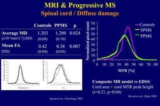 MRI markers to understand progression | PPT