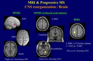 MRI markers to understand progression | PPT