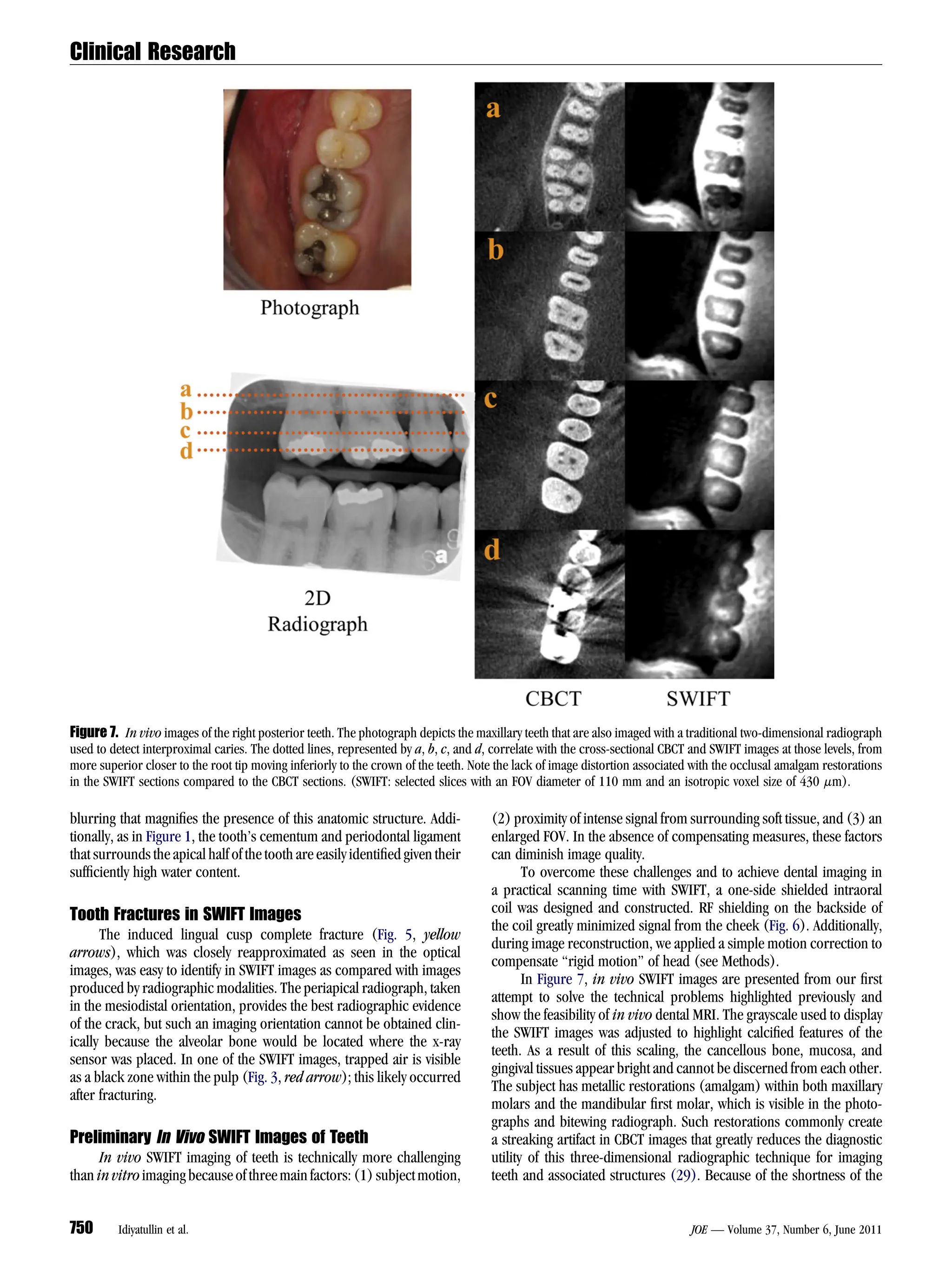 MRImicrocracks2011.pdf