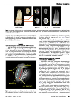 MRImicrocracks2011.pdf