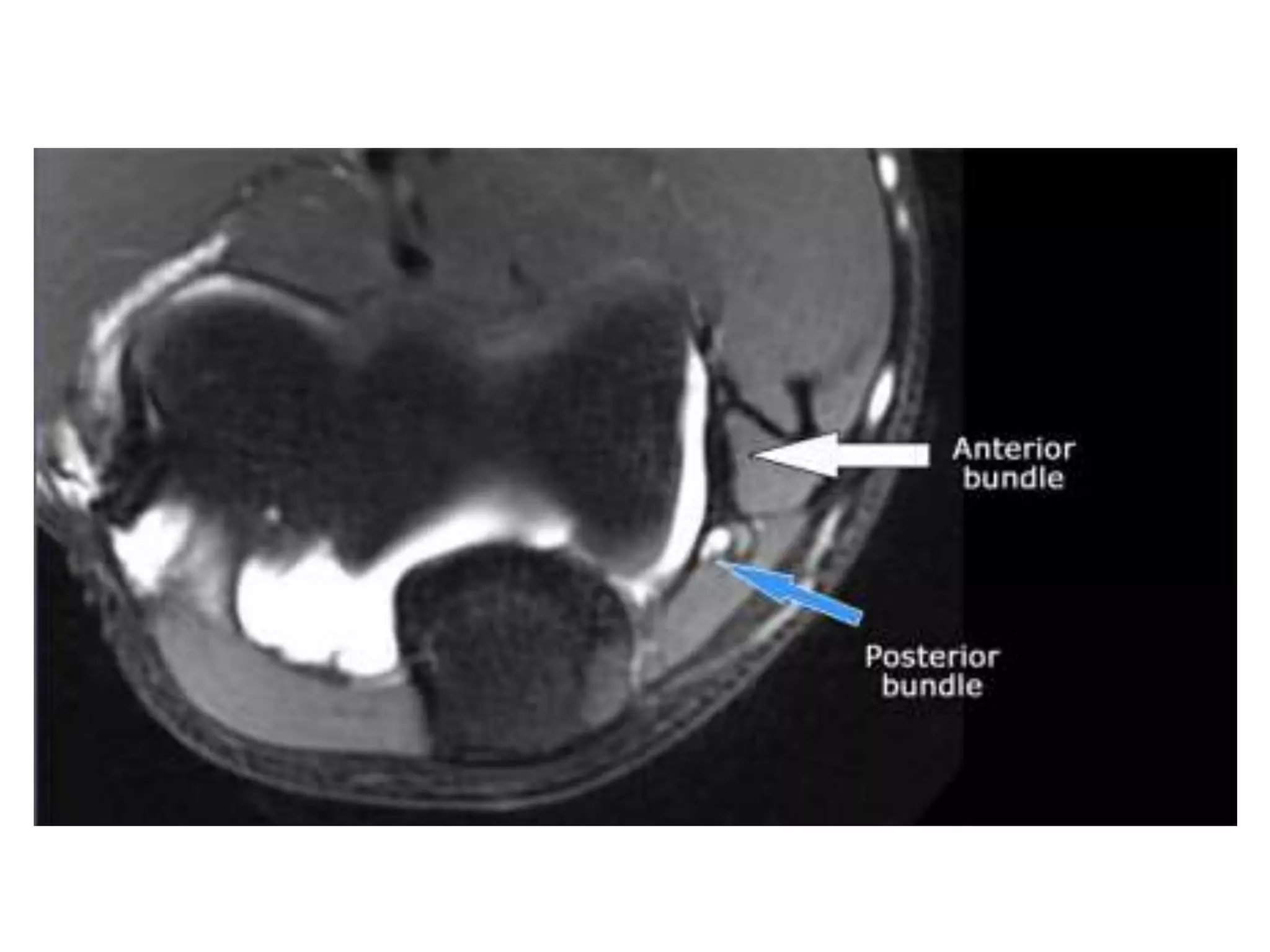 Mri msk 2 | PPTX